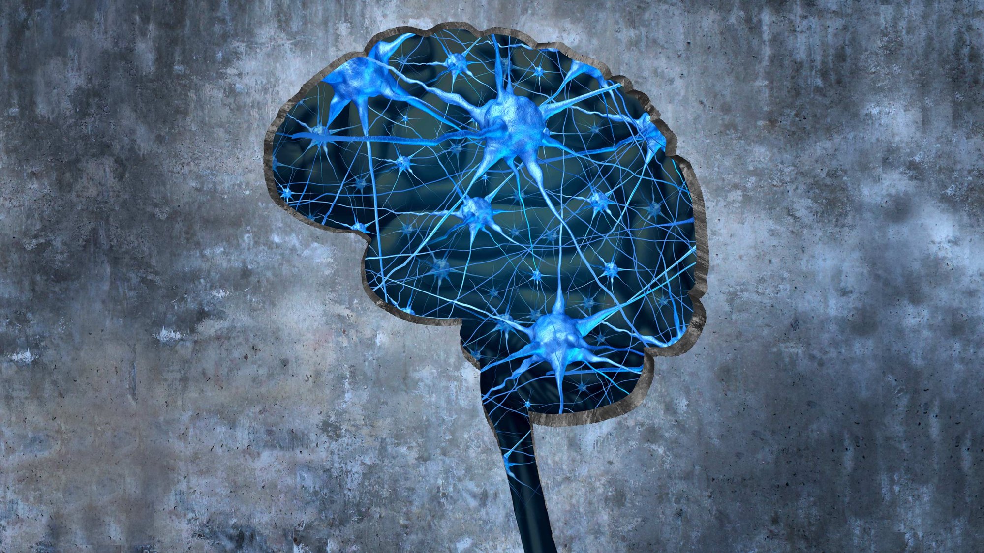 Why Students Forget—and What You Can Do About It | Edutopia